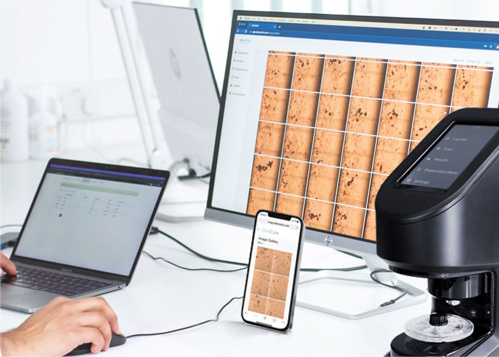 INDICAL BIOSCIENCE | OvaCyte Faecal Analyser EU | Online Shop