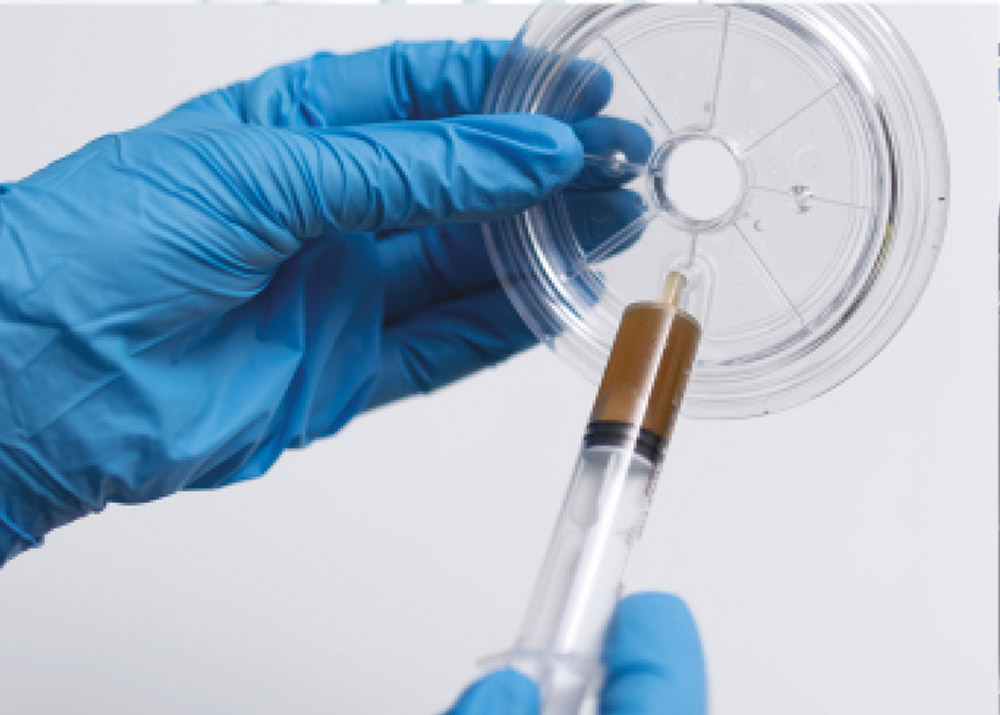 INDICAL BIOSCIENCE | OvaCyte Faecal Analyser EU | Online Shop